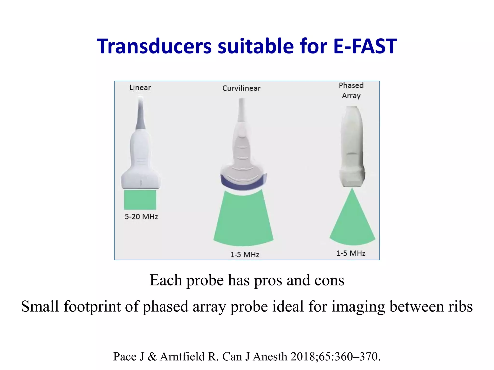 Extended focus assessment with sonography for trauma | PPTX