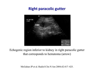 Extended focus assessment with sonography for trauma | PPTX