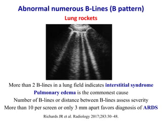Extended focus assessment with sonography for trauma | PPTX