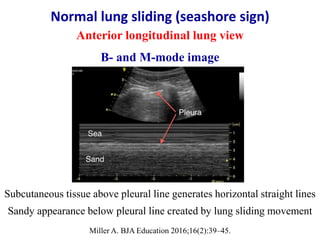Extended focus assessment with sonography for trauma | PPTX | First Aid ...