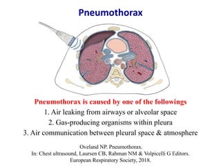 Extended focus assessment with sonography for trauma | PPTX