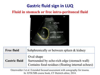 Extended focus assessment with sonography for trauma | PPTX