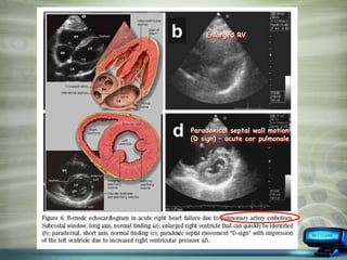 focused-echocardiographic-evaluation-in-resuscitation-management425.ppt
