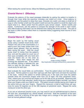 Focused Neurological Assessment | PDF