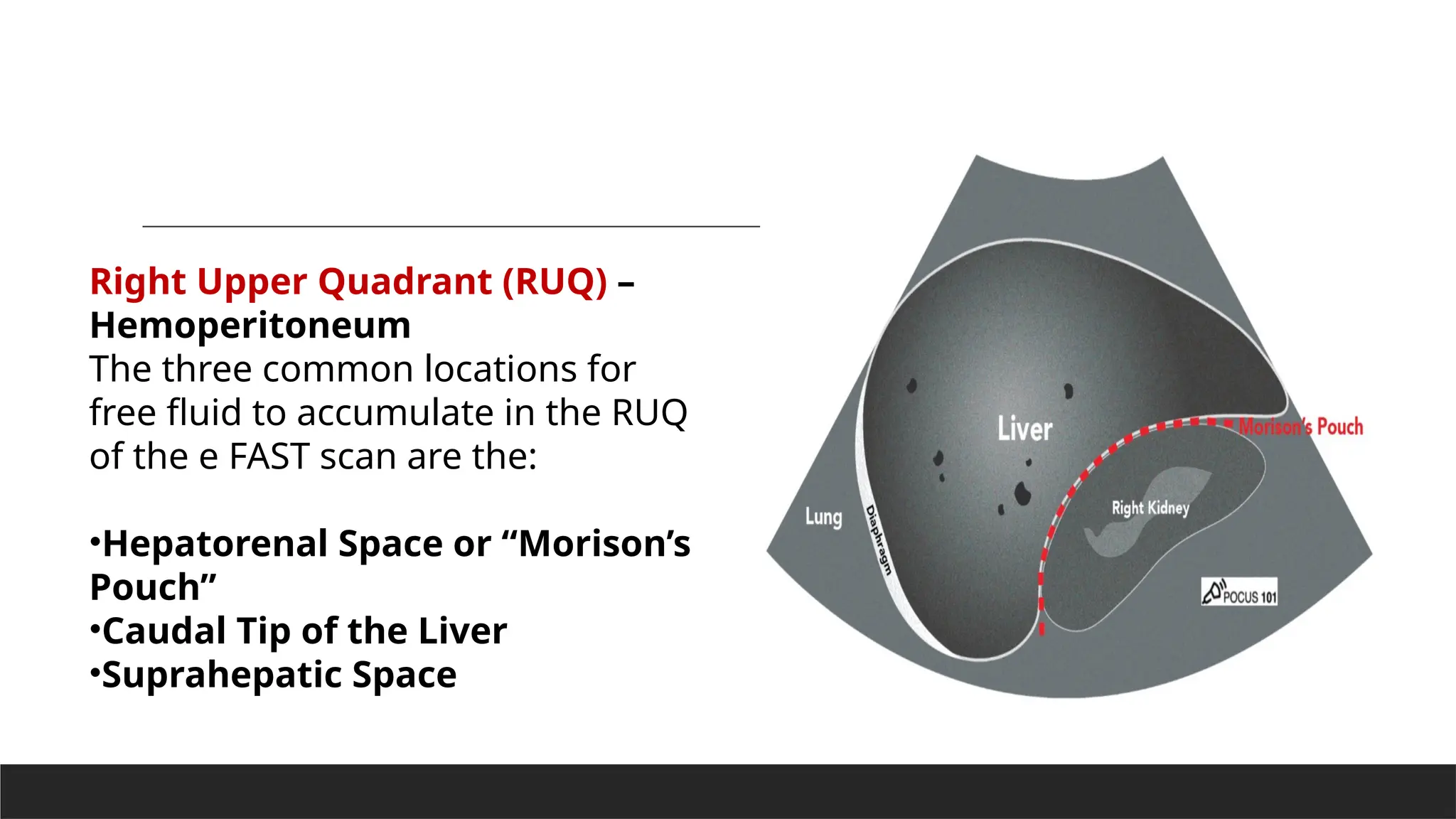 Focused Assessment with Sonography for Trauma (FAST.pptx