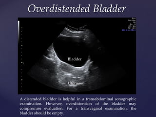 Focused reproductive endocrinology and infertility (2019) image library ...