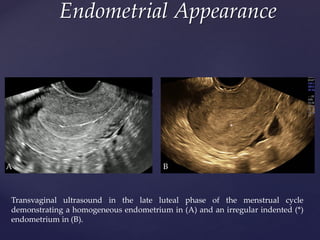 Focused reproductive endocrinology and infertility (2019) image library ...