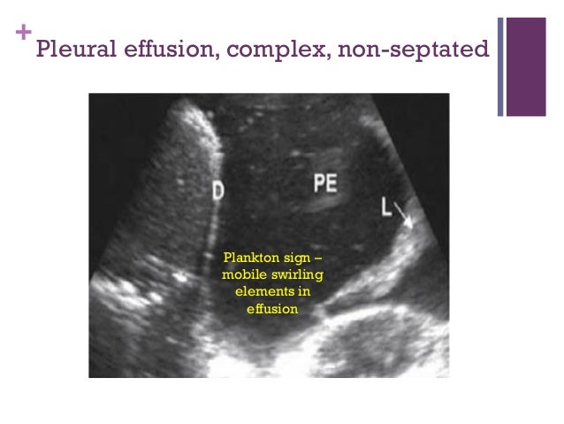 Focused thoracic ultrasound