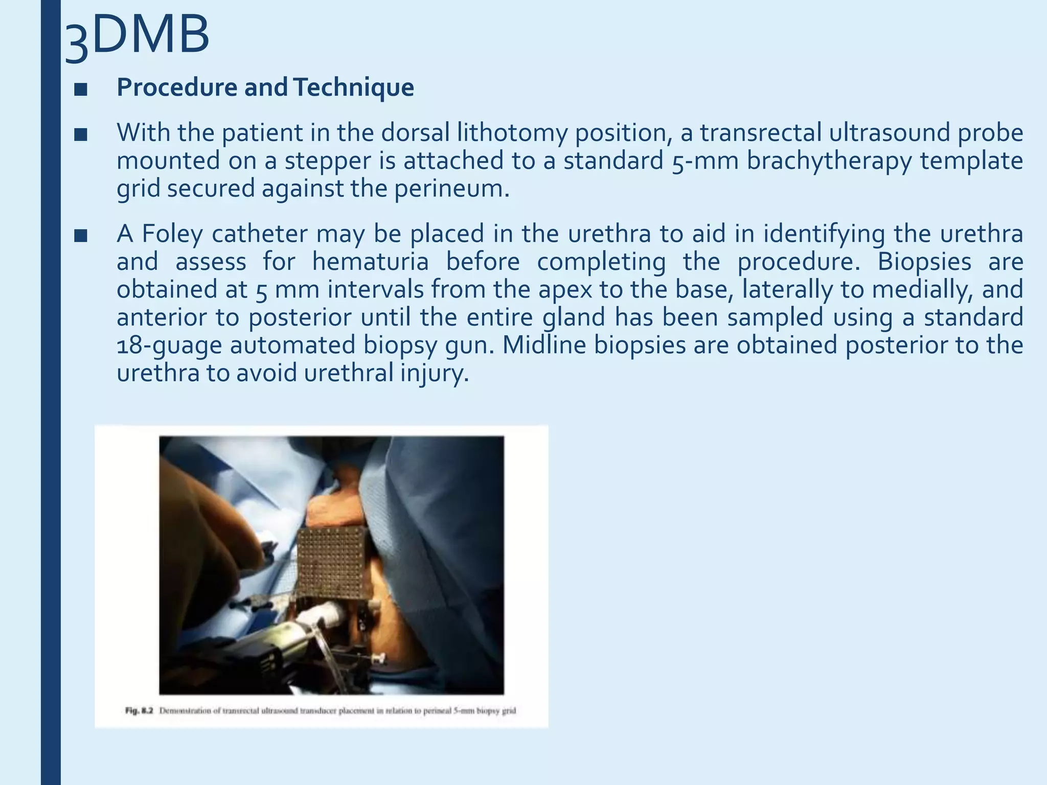 Focussed therapy and imaging in prostate cancer | PPTX