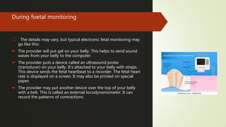 Foetal monitering instuments | PPTX | Pregnancy | Reproductive Health