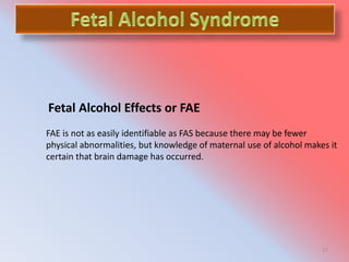 Foetal alcohol syndrome short talk | PPT