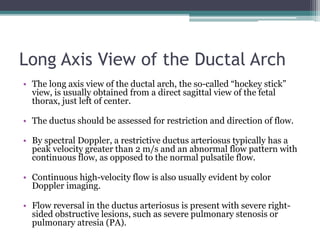 Foetal and perinatal cardiology 2.. | PPTX