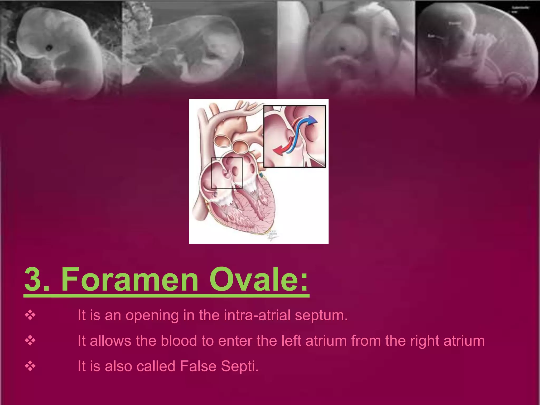 Foetal circulation ppt | PPTX