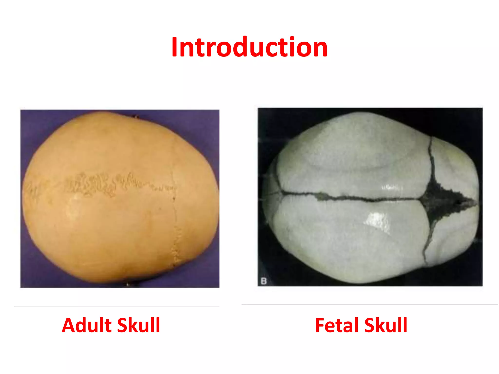 Foetal Skull Anatomy | PPTX