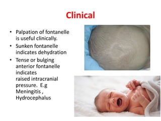 Foetal Skull Anatomy | PPTX