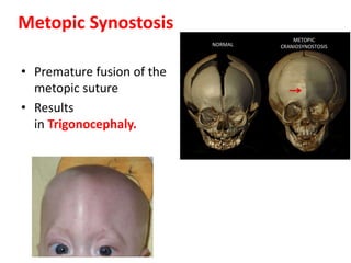 Foetal Skull Anatomy | PPT