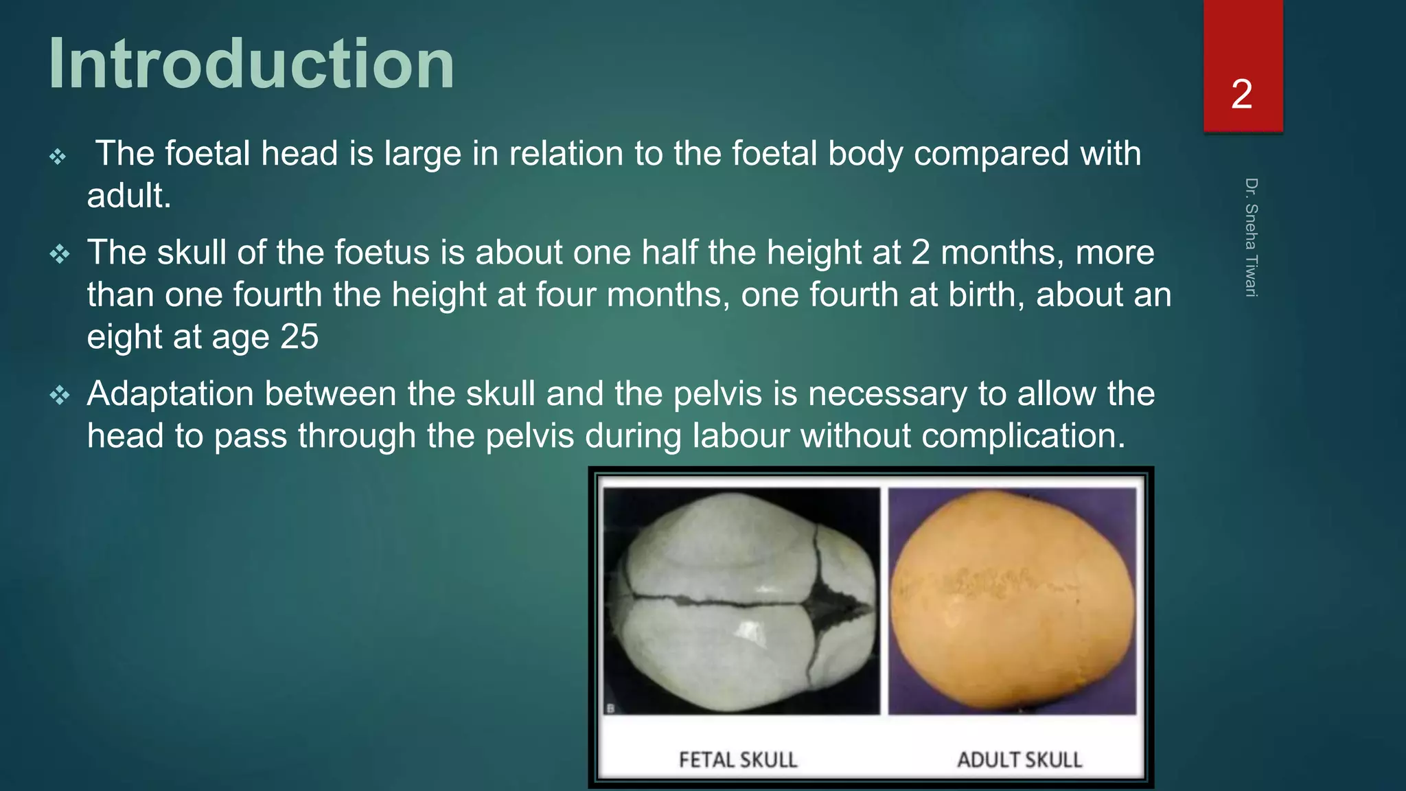 Foetal skull and maternal pelvis | PPTX