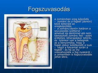 Fogaszati megelozes globe-dental_care | PPT