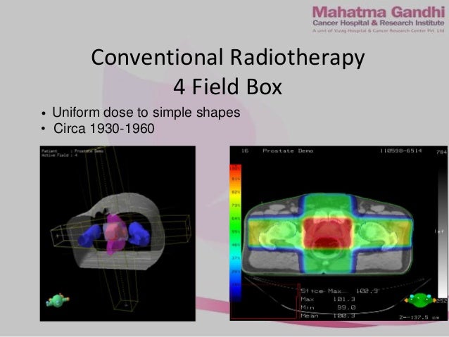 RADIOTHERAPY FOR ENDOMETRIUM AND CERVICAL CANCERS