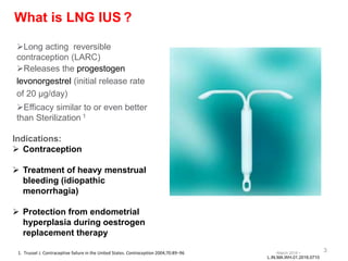ole of LNG IUS in management of AUB (Levonorgestrel intrauterine system ...