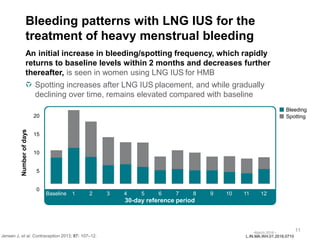 Role of LNG IUS in management of AUB (Levonorgestrel intrauterine ...