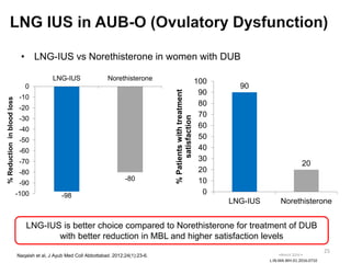 Role of LNG IUS in management of AUB (Levonorgestrel intrauterine ...