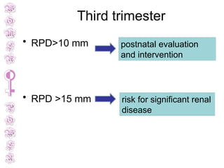 renal pelvic dilatation , antenatal managemnt and monitoring | PPTX