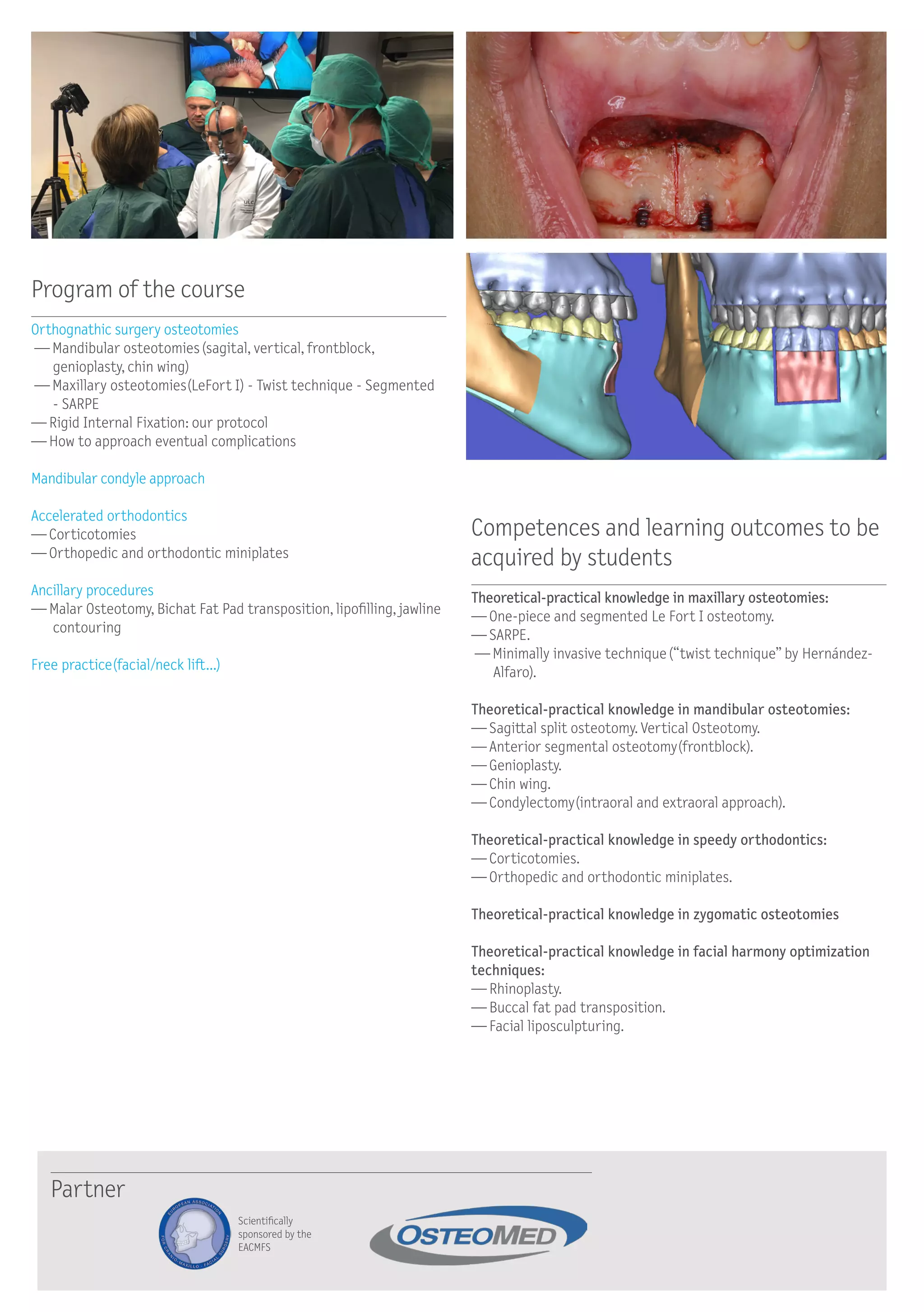Fo hands on in orthognathic surgery ancillary procedures. flyer 2019 ...