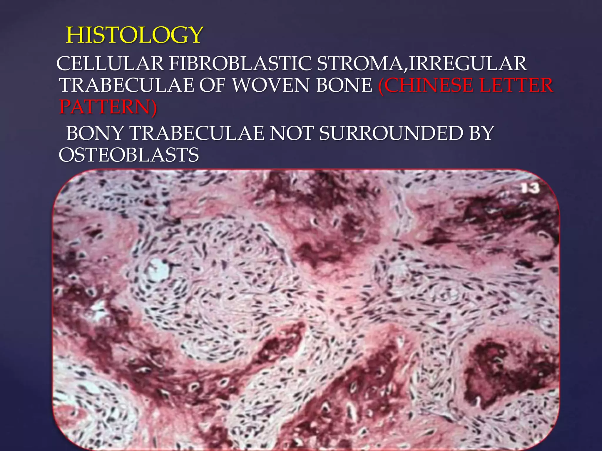 Fibro osseous lesions .pptx | Dental Health | Diseases and Conditions