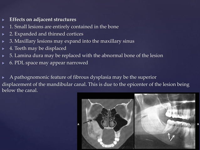 Fibro osseous lesions .pptx | Dental Health | Diseases and Conditions