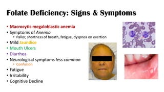 Folate deficiency anemia .pdf