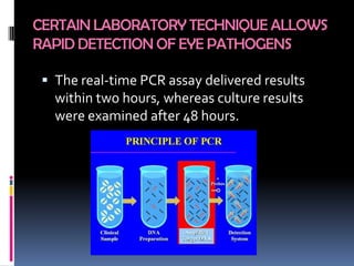PCR Polymerase Chain Reaction by Laura Mejia | PPT