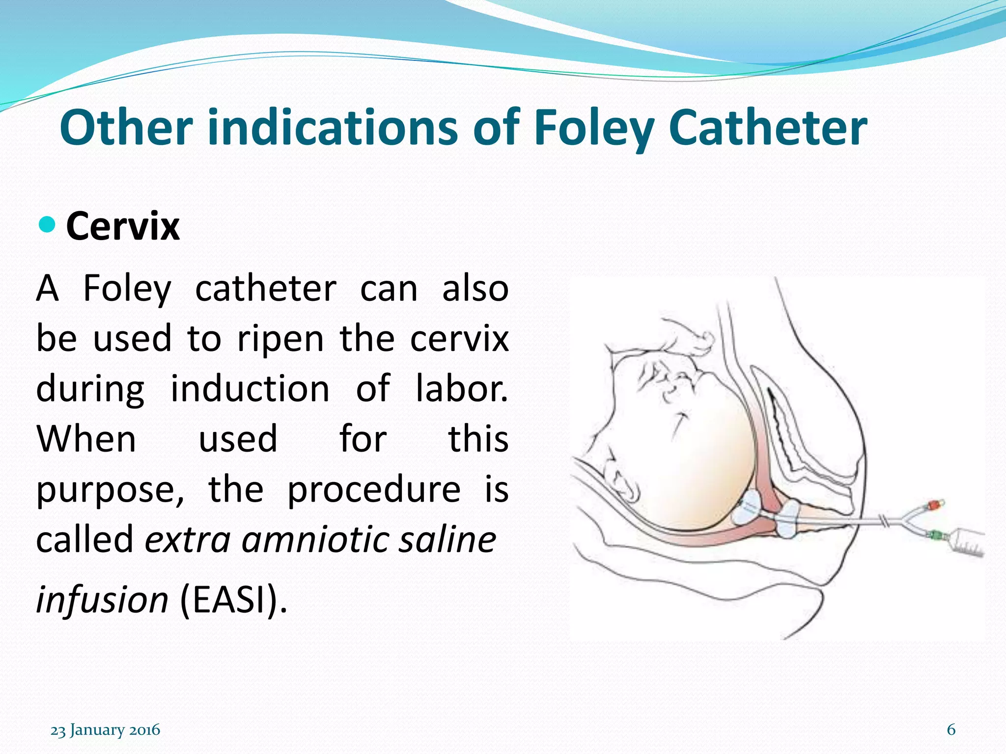 Foley cathetar and cathetarazation | PPTX