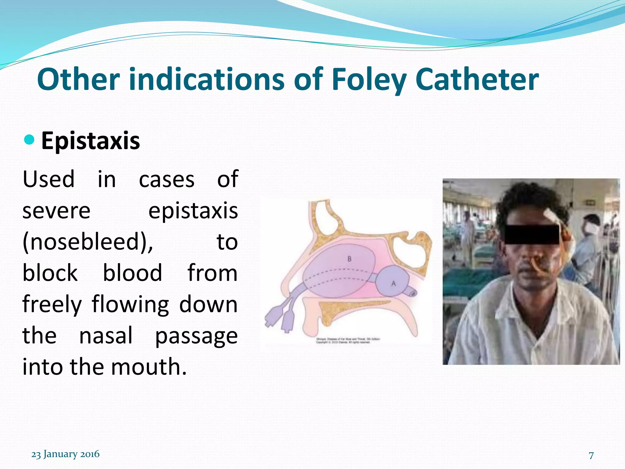 Foley cathetar and cathetarazation | PPTX