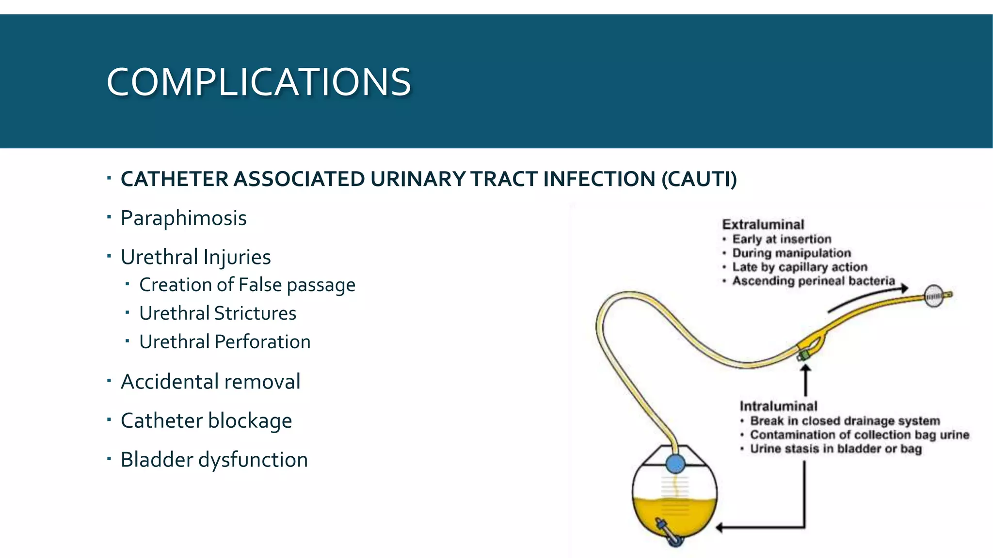 Foley catheterization | PPTX