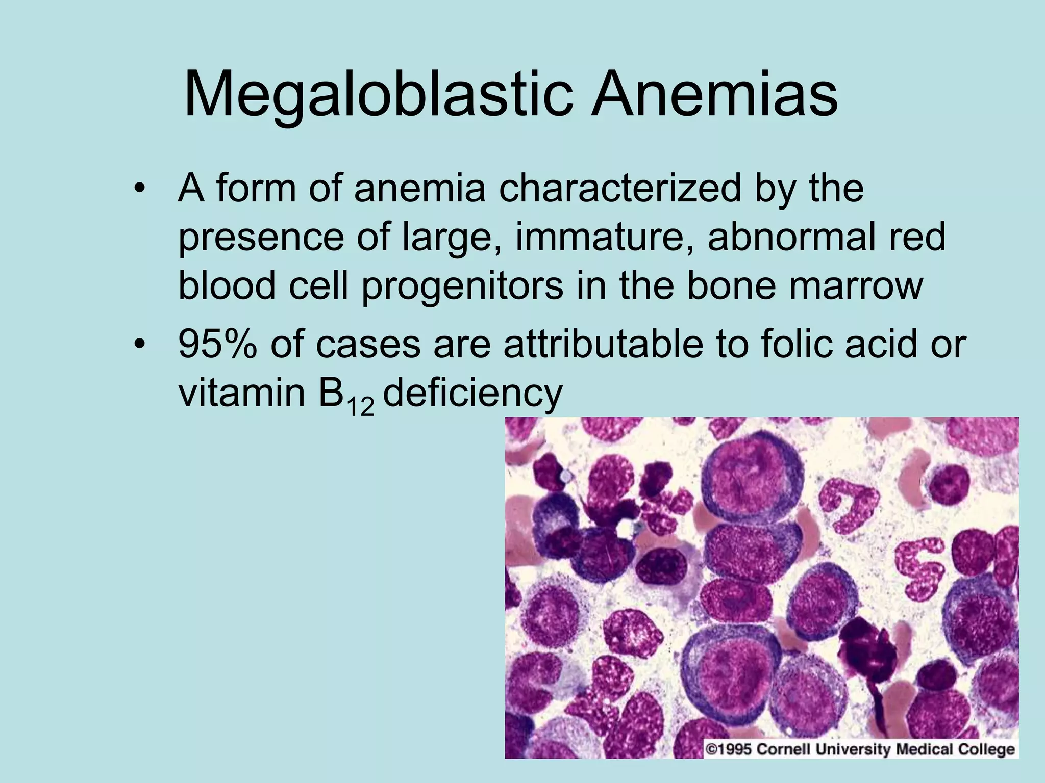 Folic_acid_B12_deficiency_Anemia_LIN_OSW.ppt