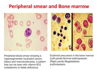 FOLIC ACID DEFICIENCY.pptx