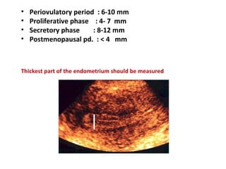 Practical tips for monitoring of an IUI cycle Dr. Jyoti Agarwal Dr ...