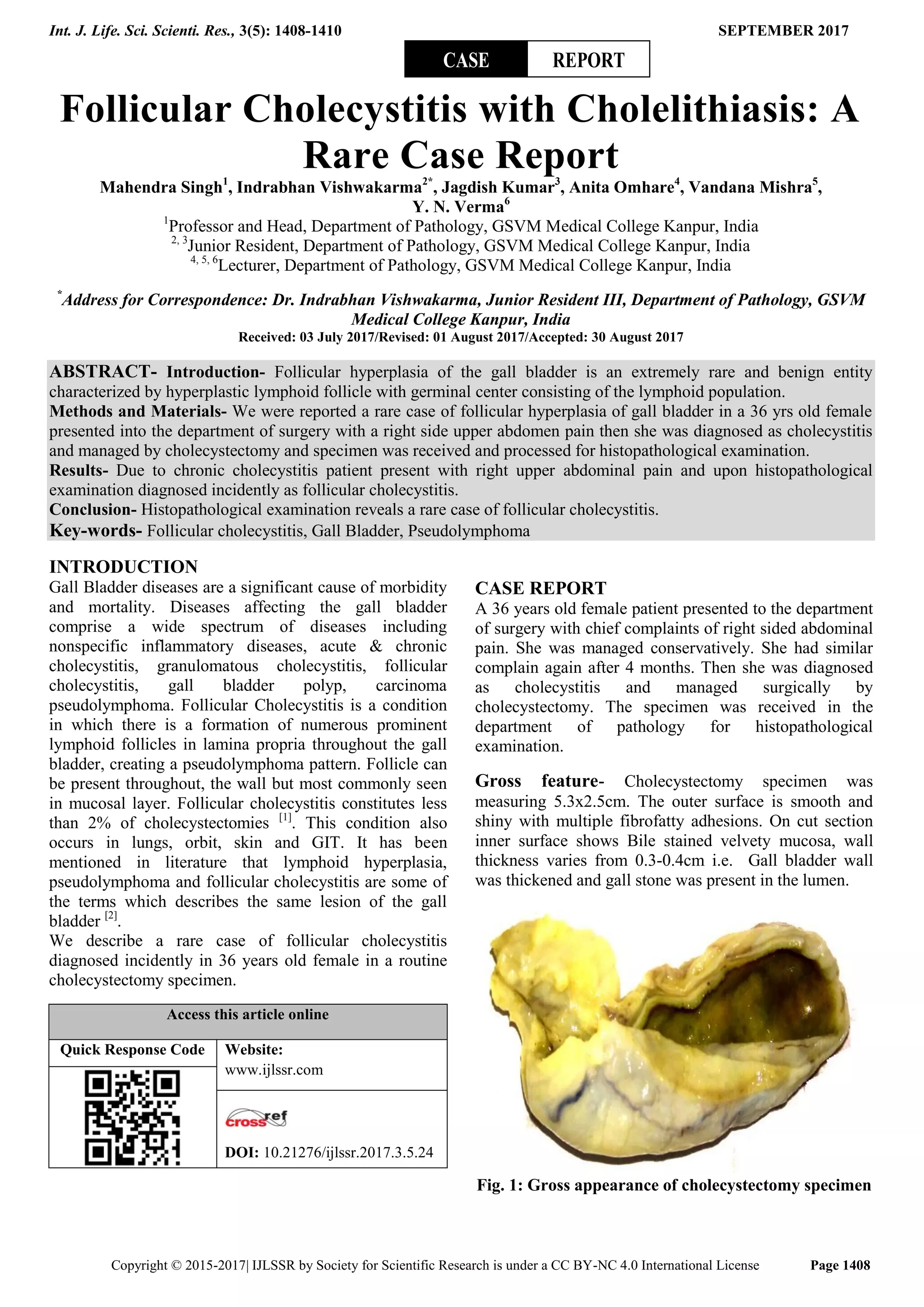 Follicular Cholecystitis with Cholelithiasis: A Rare Case Report | PDF