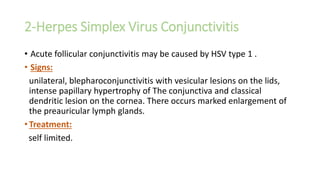 Follicular conjunctivitis (1) | PPTX