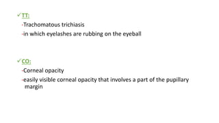 Follicular conjunctivitis (1) | PPTX