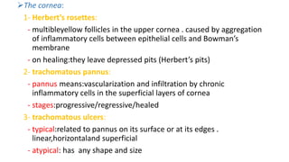 Follicular conjunctivitis (1) | PPTX