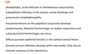 Follicular conjunctivitis (1) | PPTX