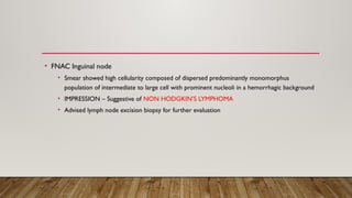 FOLLICULAR LYMPHOMA.pptx FOLLICULAR LYMPHOMA.pptx