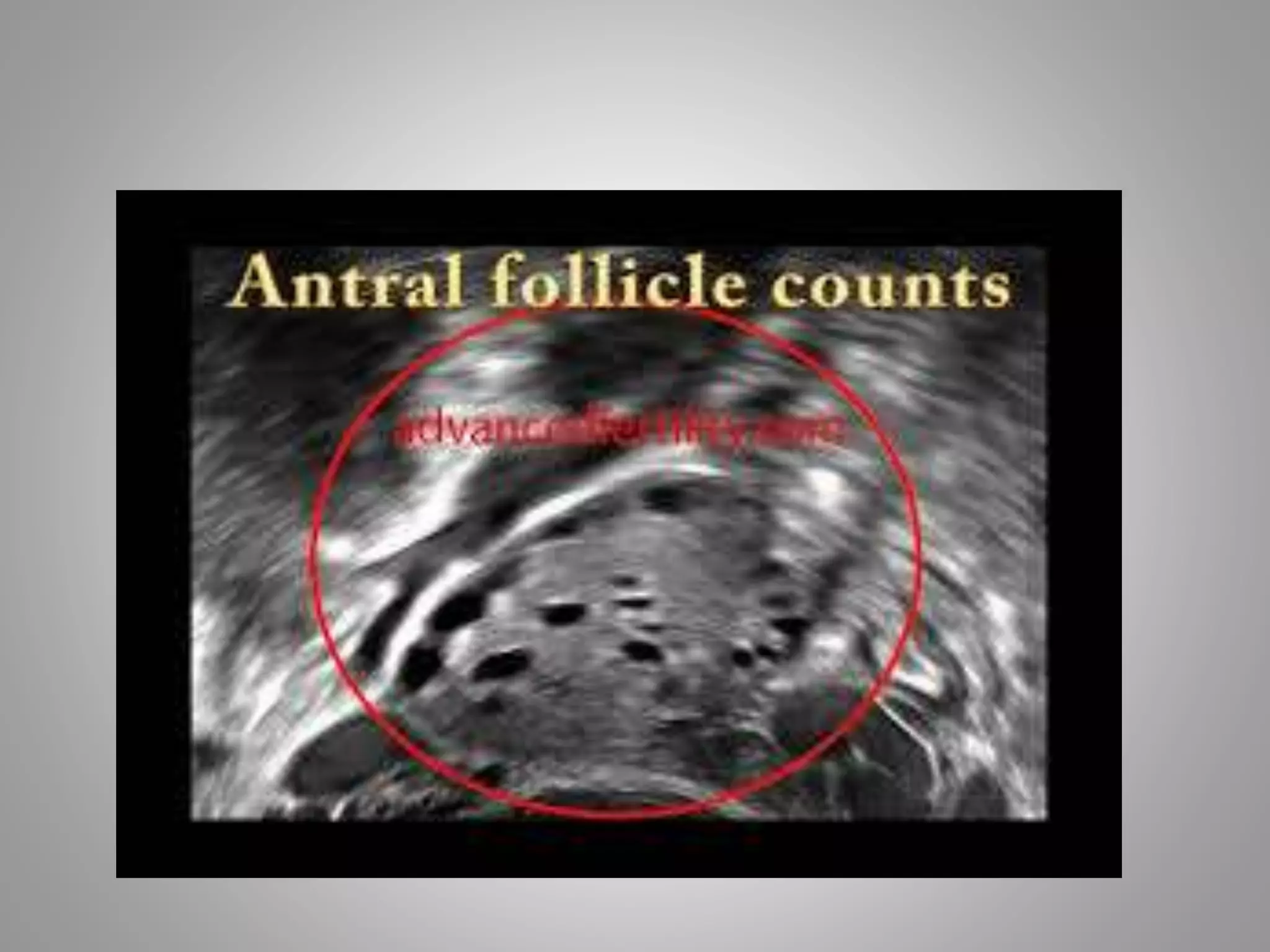 Follicular study | PPTX