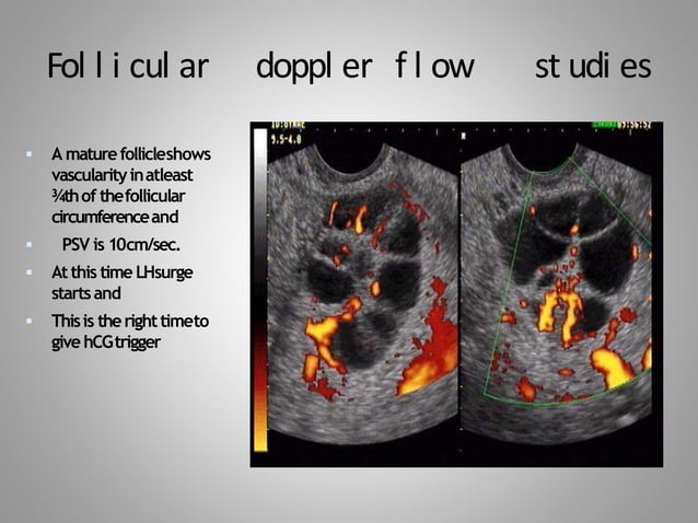 Follicular study | PPTX | Pregnancy | Reproductive Health