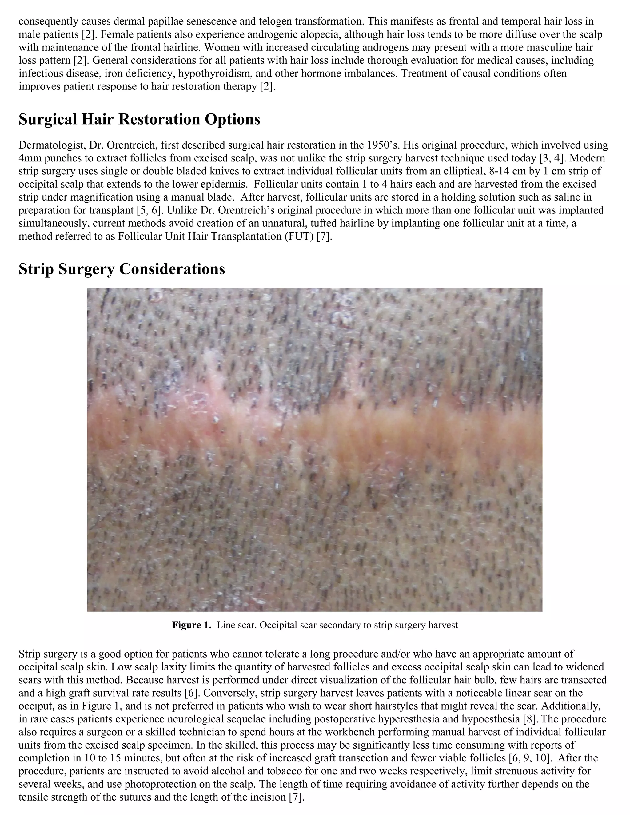 Follicular Unit Extraction Hair Transplant Harvest: A Review of Current ...