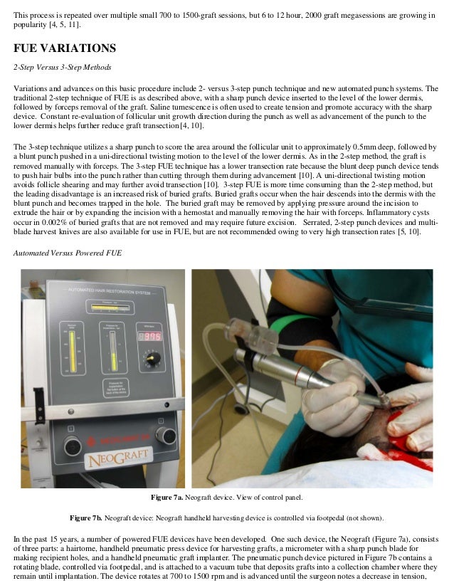 Follicular Unit Extraction Hair Transplant Harvest A Review Of Curre…