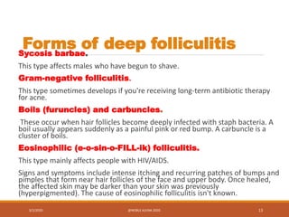 Folliculitis | PPTX