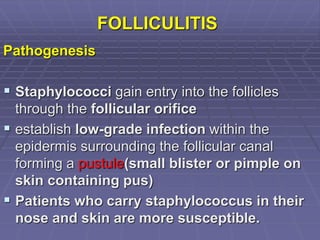 FOLLICULITIS.ppt